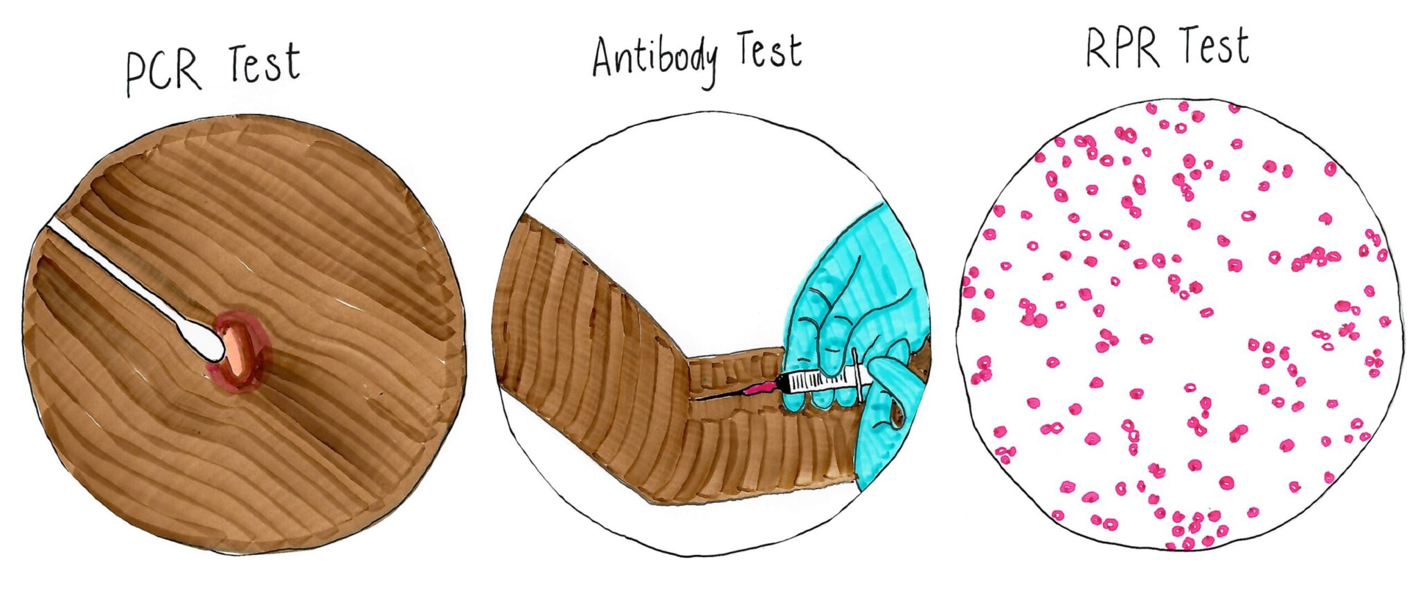 Syphilis | Red Book Online